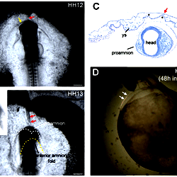 Passive displacement of somatopleure and splanchnopleure due to the ...
