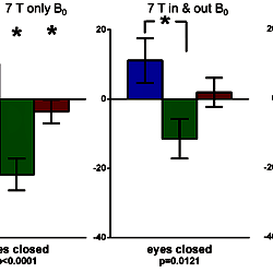 Unterberger's test results (phase 2) indicating rotational behavior of ...