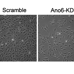 Effects of Ano6-KD on the proliferation of C2C12 myoblasts.