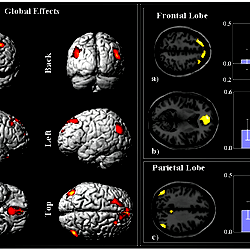 Overall task relevant activations – fMRI data.