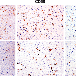 Immunohistochemical staining of liver Kupffer cells/macrophages for F4/80, CD68 and CD11b ...