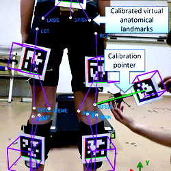 Calibration of anatomical points using the calibration pointer.