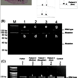 Loss of heterozygosity (LOH) analysis of lung tissue from patient 2 ...