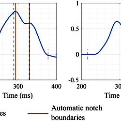 Examples of automatic (red lines) and reference (grey dashed lines ...