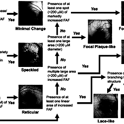 Flow chart for classifying abnormal FAF.
