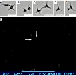 Intermediate forms in the culture.