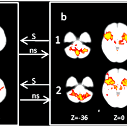 Synopsis of fMRI activations elicited by the Go-/noGo task vs. rest.