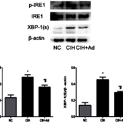 IRE1 pathway activation in heart.