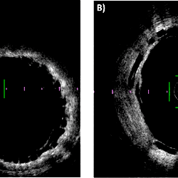 Example of ‘poor’ and ‘good’ quality image.