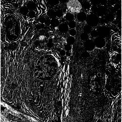 Ultrastructure of chief cells in the CGG.