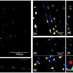 Modulation of endothelial cell (EC) pattern.