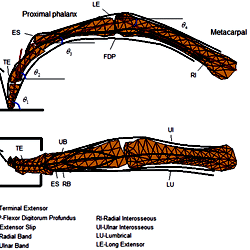 Full Model of the finger with extensor mechanism.