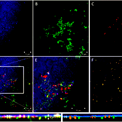 CLSM images of Test Model I.