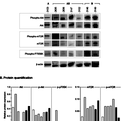 Activation of the Akt/ mTOR pathway in thymoma-derived thymic ...