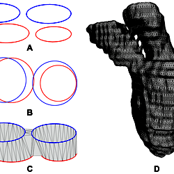 Common errors during reconstruction.