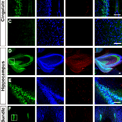Leaky expression of channelrhodopsin-2 (ChR2) in Ai32 mouse lines - Fig 2
