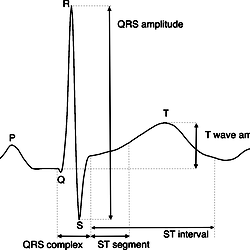 Schematic ECG parameters.