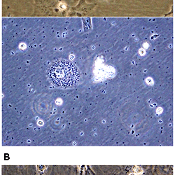 T. cruzi-infected culture cells were stored for various lengths of time ...