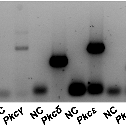 Expression of Pkc isoforms in UMR106 osteoblast-like cells.