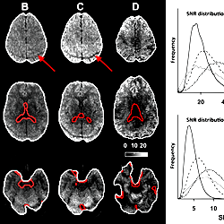 Tensor-valued diffusion encoding for diffusional variance decomposition (DIVIDE): Technical ...