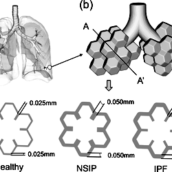 Geometric models of pulmonary acinus.