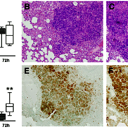 Lung histopathology and neutrophil recruitment.