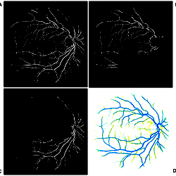 Overview of the main steps taken by our algorithm when processing a ...