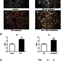 Effects of different treatment on lipid accumulation of L02 cells.