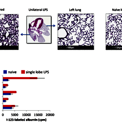 In single-lobe lung injury, some pathological phenotypes are restricted ...