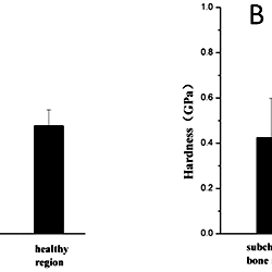 The elastic modulus and hardness of bone trabeculae in various regions.