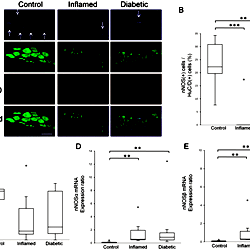Changes of myenteric neurons in BB rats.