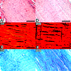 Histological appearance of the superficial digital flexor tendon (SDFT ...