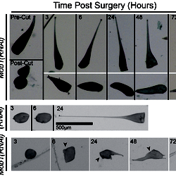 Residual Mob1 in the anterior and posterior can be surgically removed.