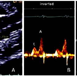 Transesophageal echocardiography of spontaneously hypertensive rats ...
