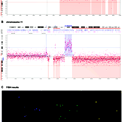 FISH analysis to confirm array CGH results.