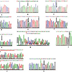 PHEX gene mutation sequencing diagram.