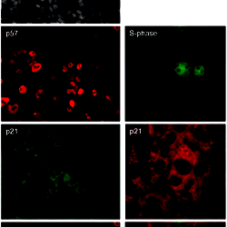 The p21 protein localized to the cytoplasm of both S-phase and G-phase ...