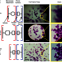 Comparison of mobile phone microscopes.