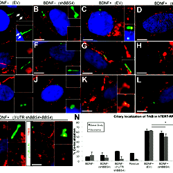 TRKB localizes to the basal body and axoneme of hTERT-RPE1 cells in the ...