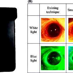 The appearance of Smart Eye Camera and representative photo.