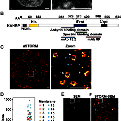 Visualizing knob structures at the external and internal surfaces.