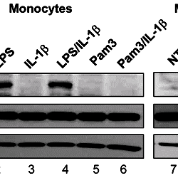 IRF3 is phosphorylated in monocytes but not in macrophages following ...