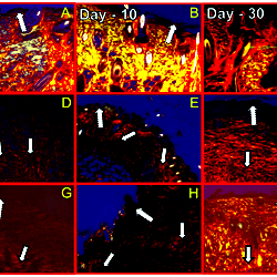 Collagen birefringence under polarized light microscopy.