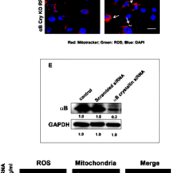 Increased production of reactive oxygen species (ROS) in mouse primary ...