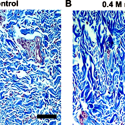 Effects of scleral collagen crosslinking with different carbohydrate on ...