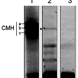 HPTLC analysis of CMH released by S. apiospermum in the culture ...