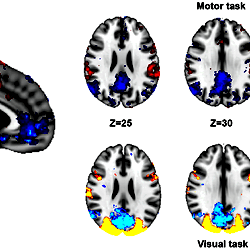 Motor and visual task activation.