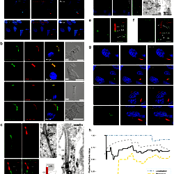Validation by ciliary localization.