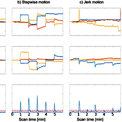 Examples of position parameters obtained from the navigators in the T1 sequence, for the ...