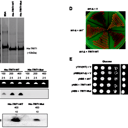 Mutant TRIT1 has decreased in vitro activity and cannot complement tit1 ...